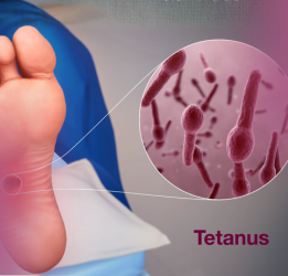 Tetanus - SP Medifort Hospital