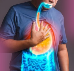 Gastroesophageal Reflux Disease (GERD) - SP Medifort Hospital